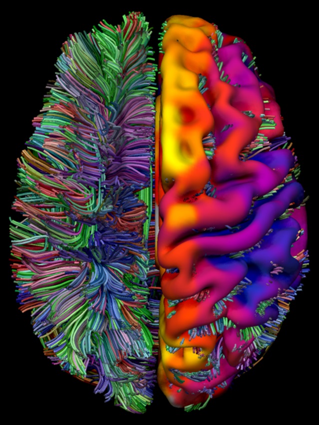 Our paper "Heritability and Cognitive Relevance of Structural Brain ...